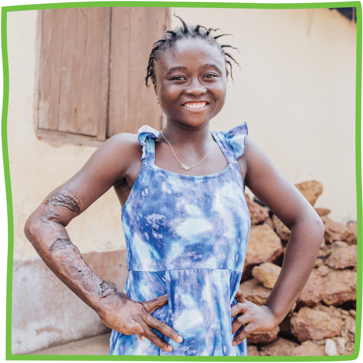Plastic Reconstructive Surgery – Mercy Ships Australia